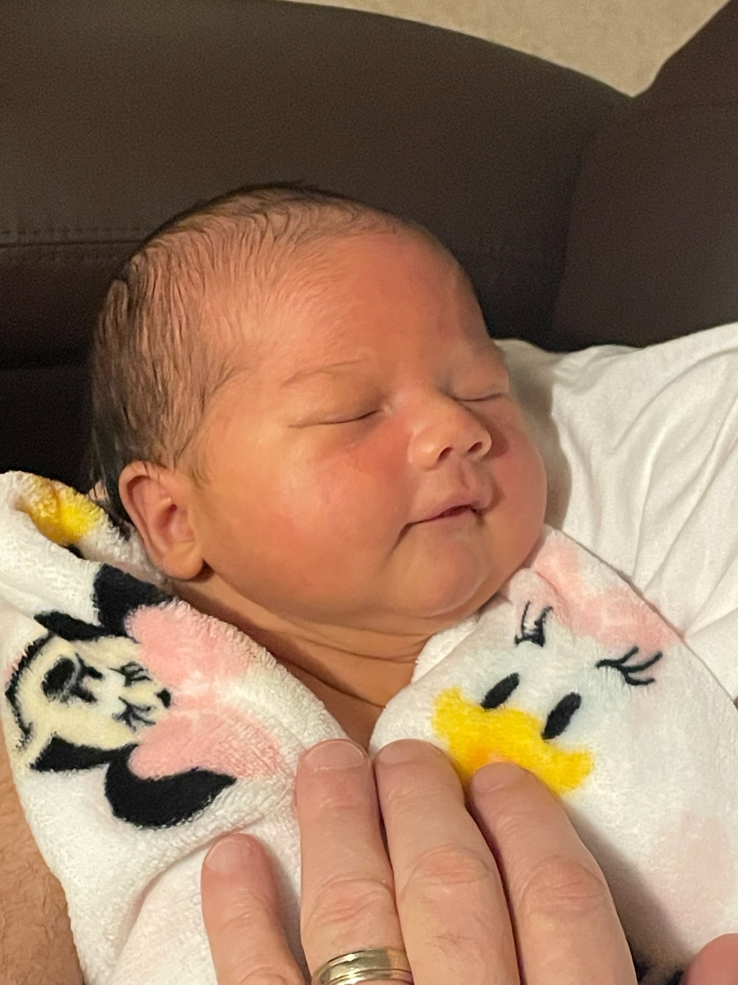 Microscopic Vasectomy Reversal Urologist